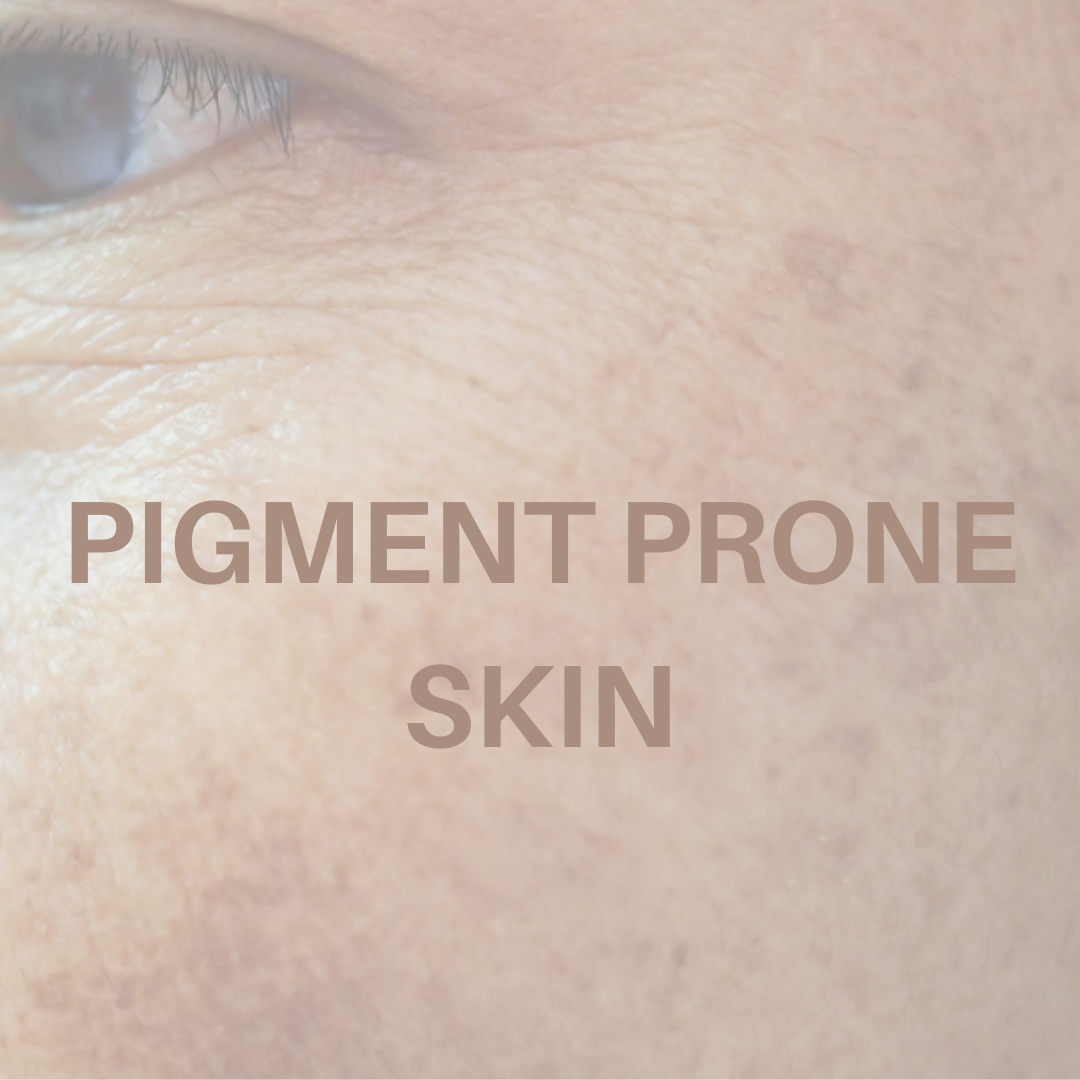 Fixation Skincare and Laser Clinic | Millhouses | Sheffield